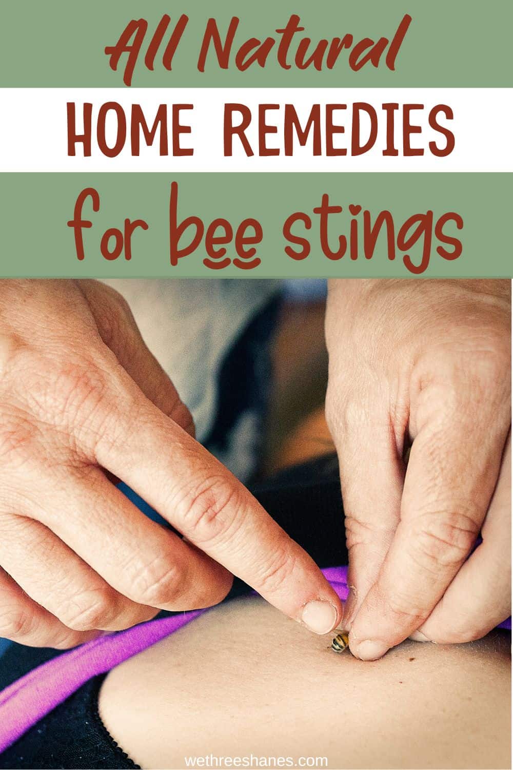 Natural Home Remedies For Bee Stings | We Three Shanes