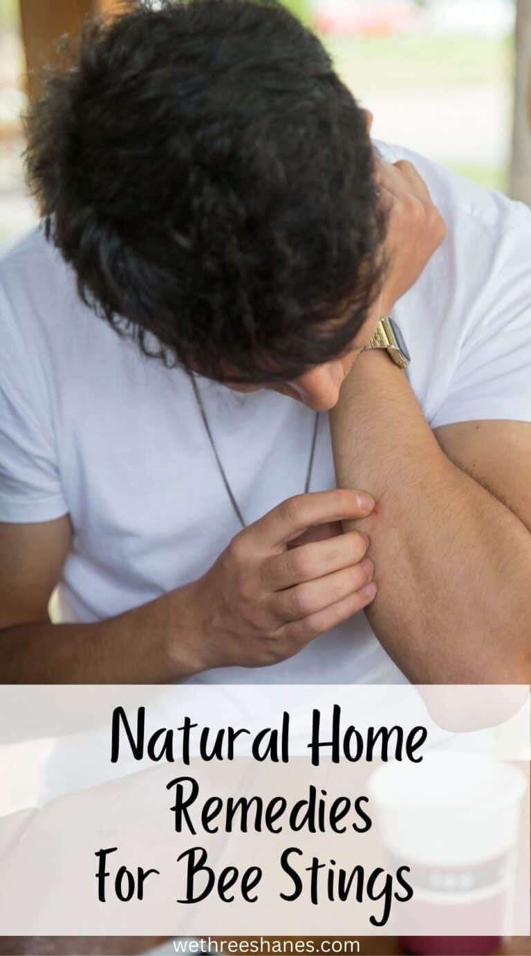 Natural Home Remedies For Bee Stings | We Three Shanes